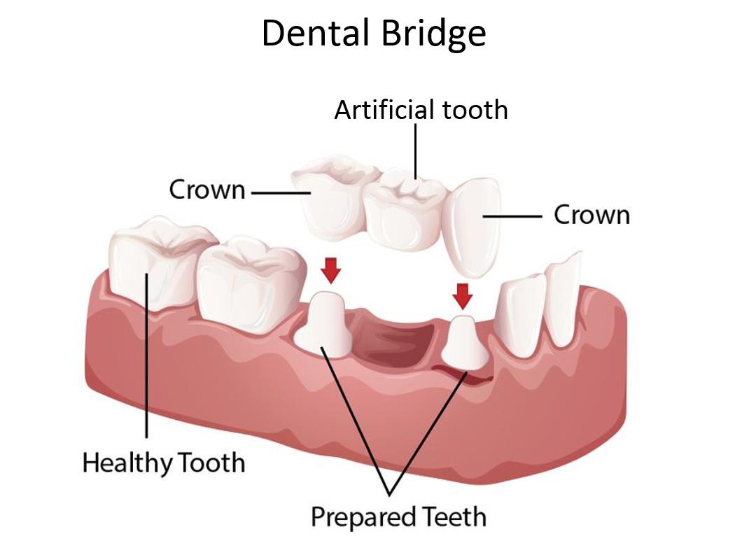Cosmetic Dentistry - Lakeview Dental Clinic